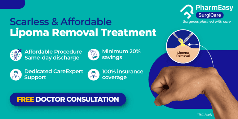 Best Home Remedies For Lipoma