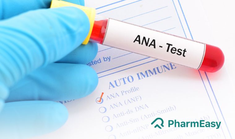 एएनए एलिसा टेस्ट (ANA Elisa Test): क्या है, नॉर्मल रेंज, खर्च, कब और ...