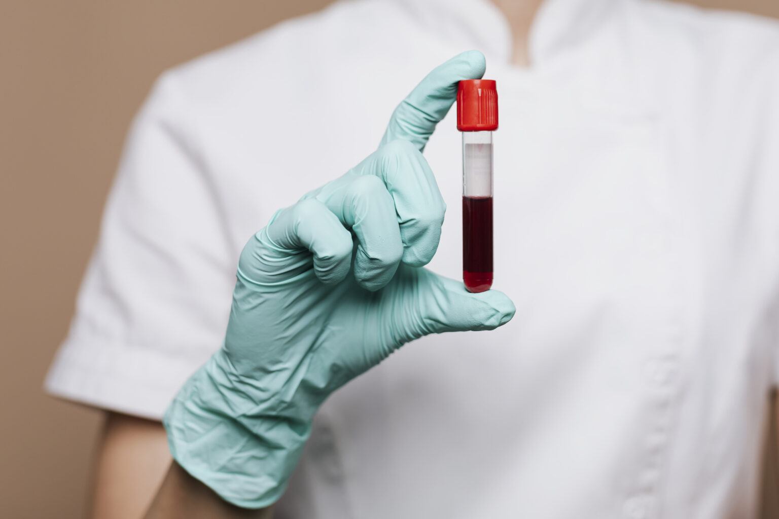 High Erythrocyte Sedimentation Rate (ESR): Symptoms, Causes ...